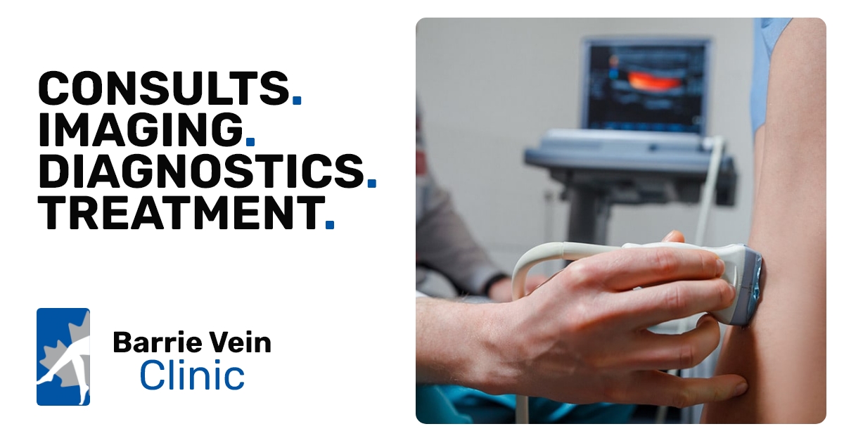 Vein Consultation & Treatments Barrie - Barrie Vein Clinic